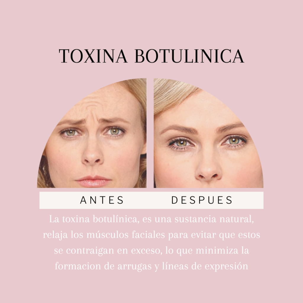 Toxina Botulínica – Vero Corpo
